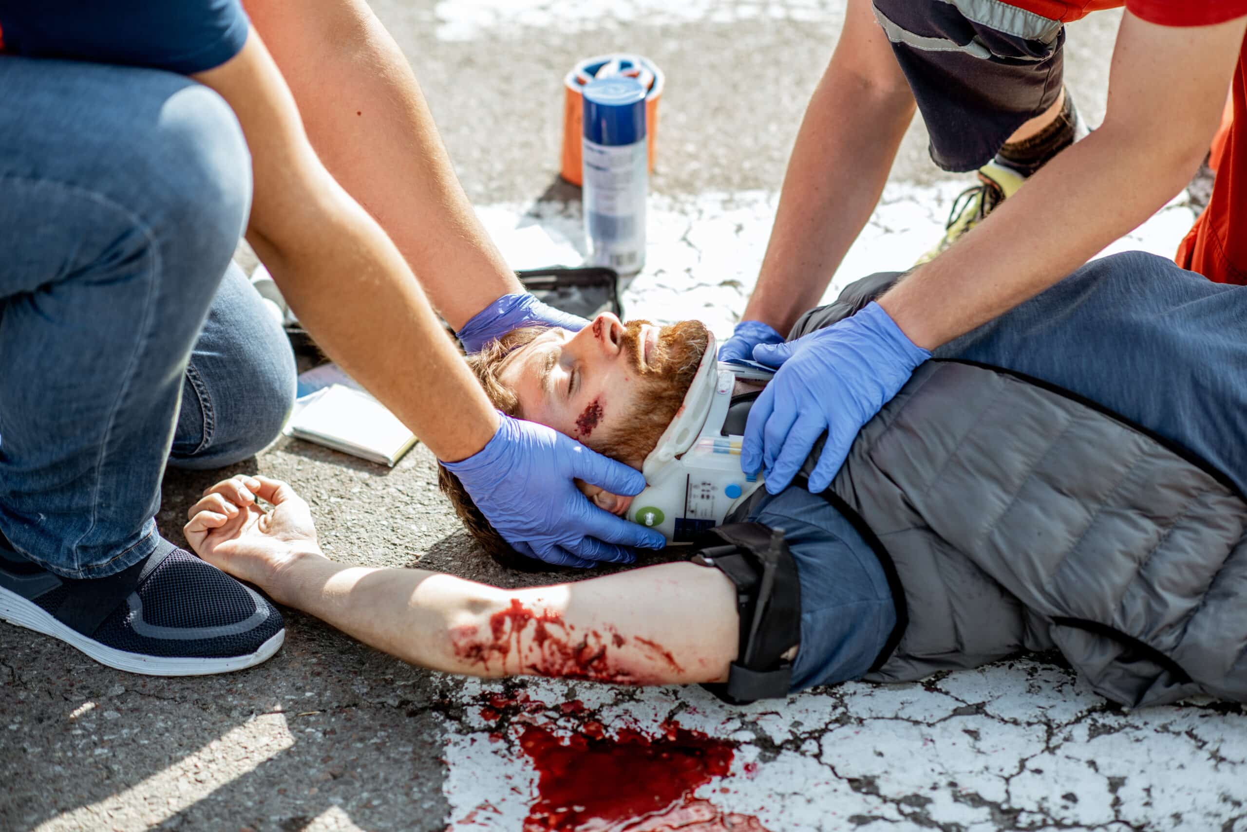 What Is Bodily Injury in a Car Accident?