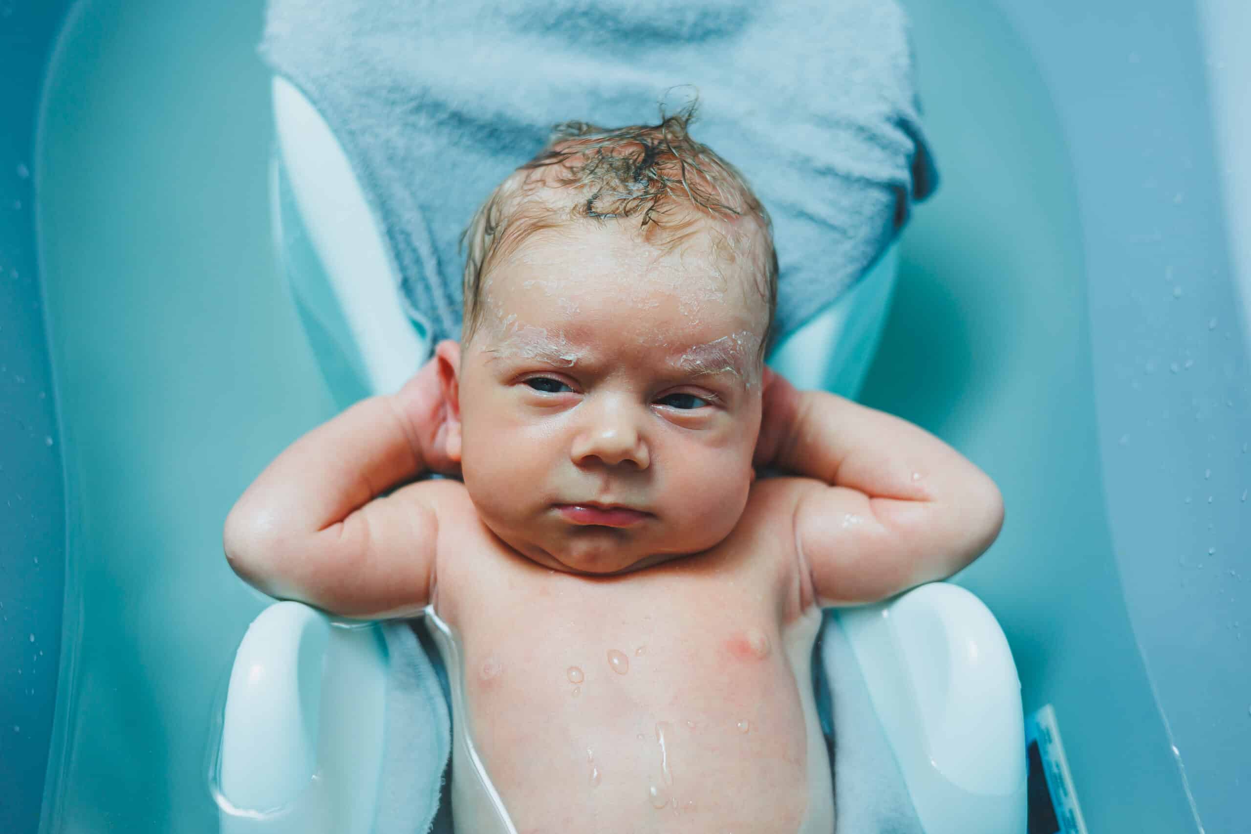 Denver Hydrocephalus Birth Injury Lawyer